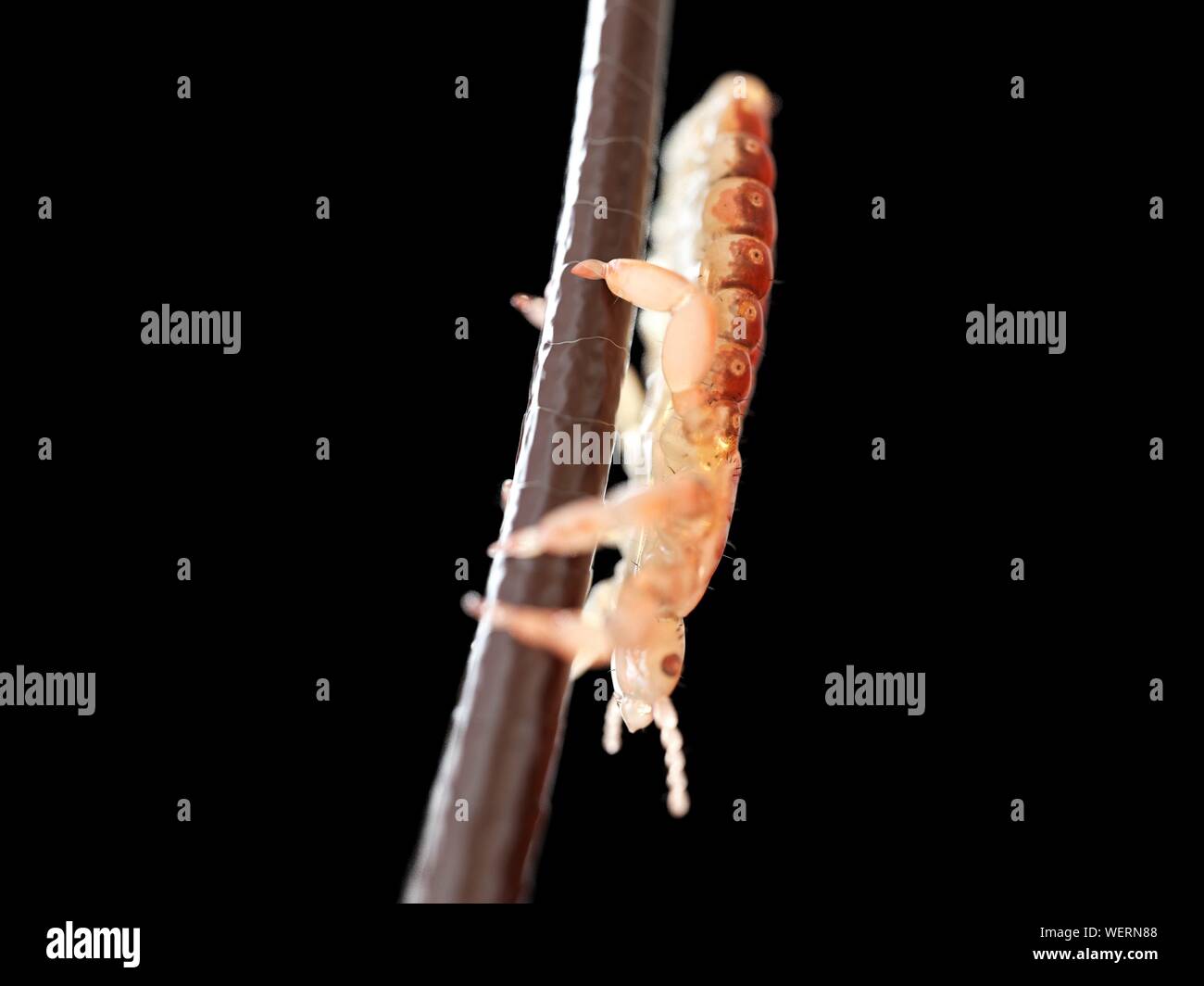 Head louse, illustration Stock Photo - Alamy