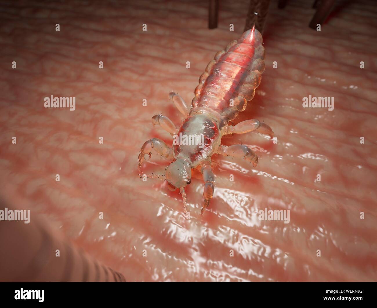 Head louse, illustration Stock Photo - Alamy
