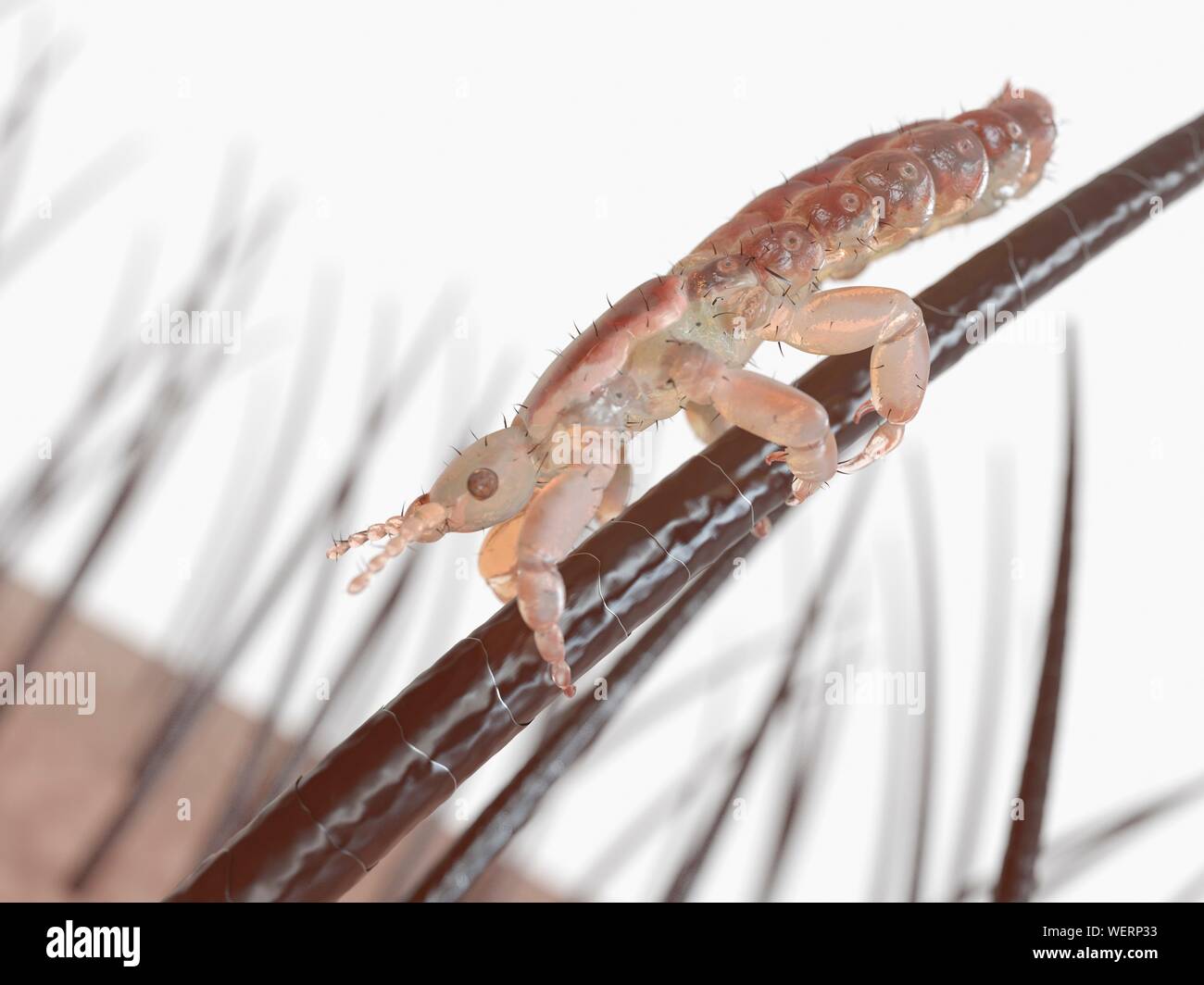 Head louse, illustration Stock Photo - Alamy