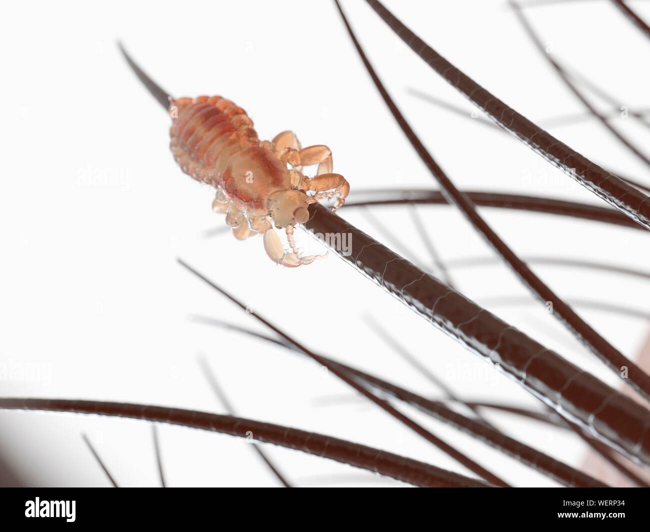 Head louse, illustration Stock Photo - Alamy