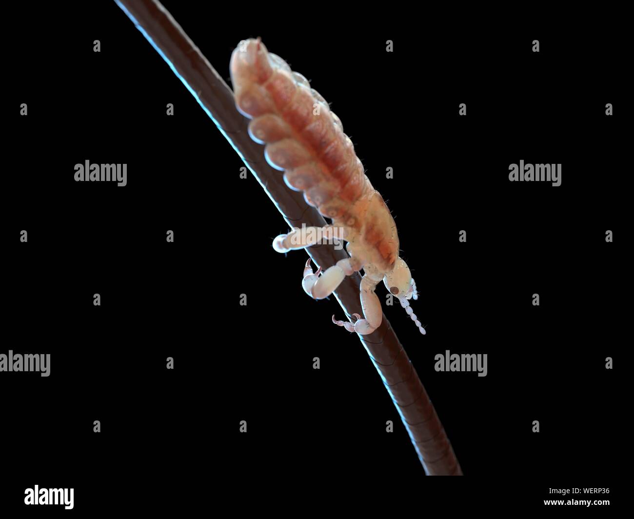 Head louse, illustration Stock Photo - Alamy