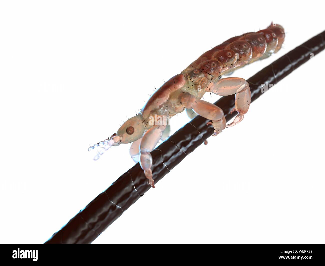 Head lice bite Cut Out Stock Images & Pictures - Alamy