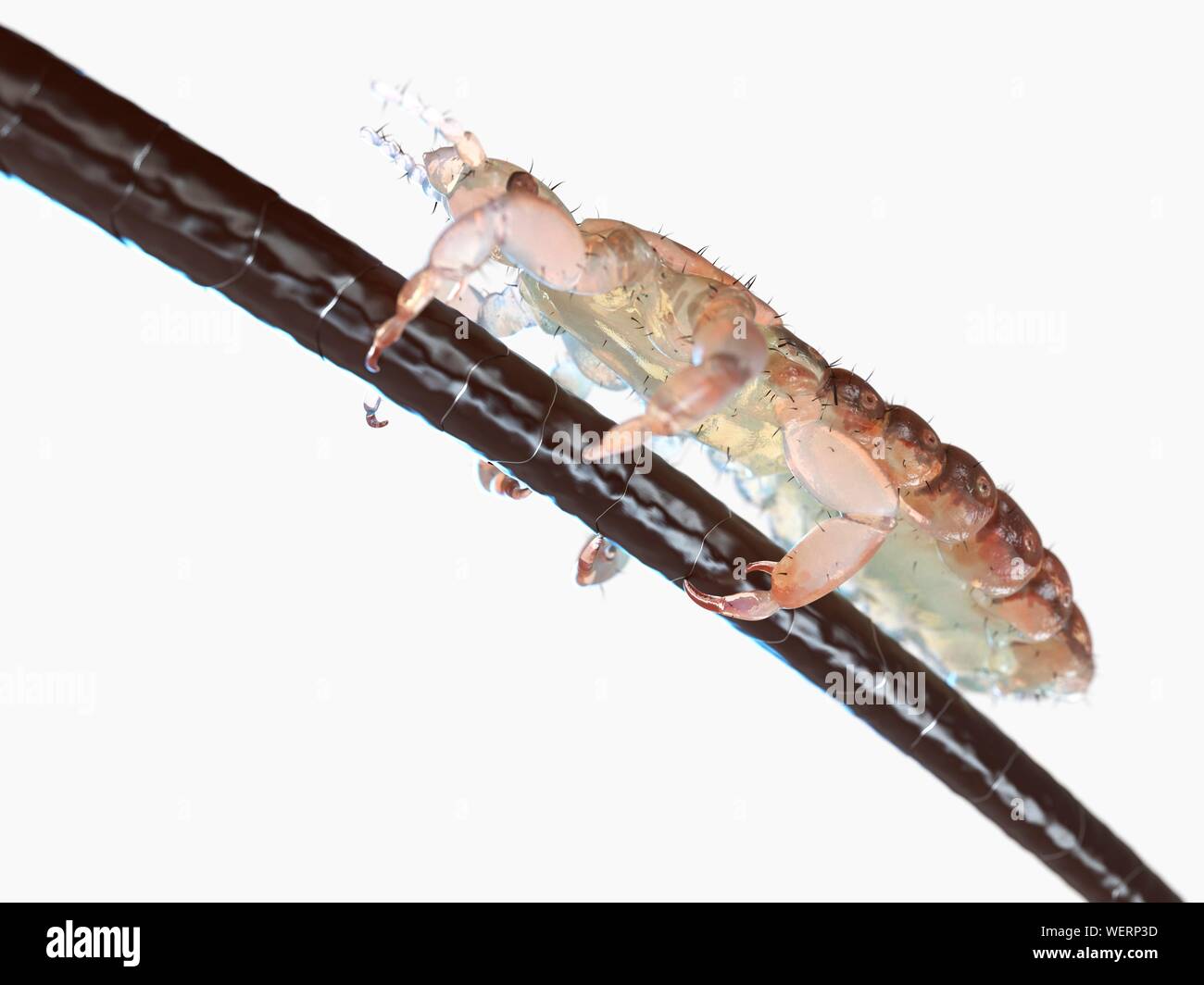 Head louse, illustration Stock Photo - Alamy