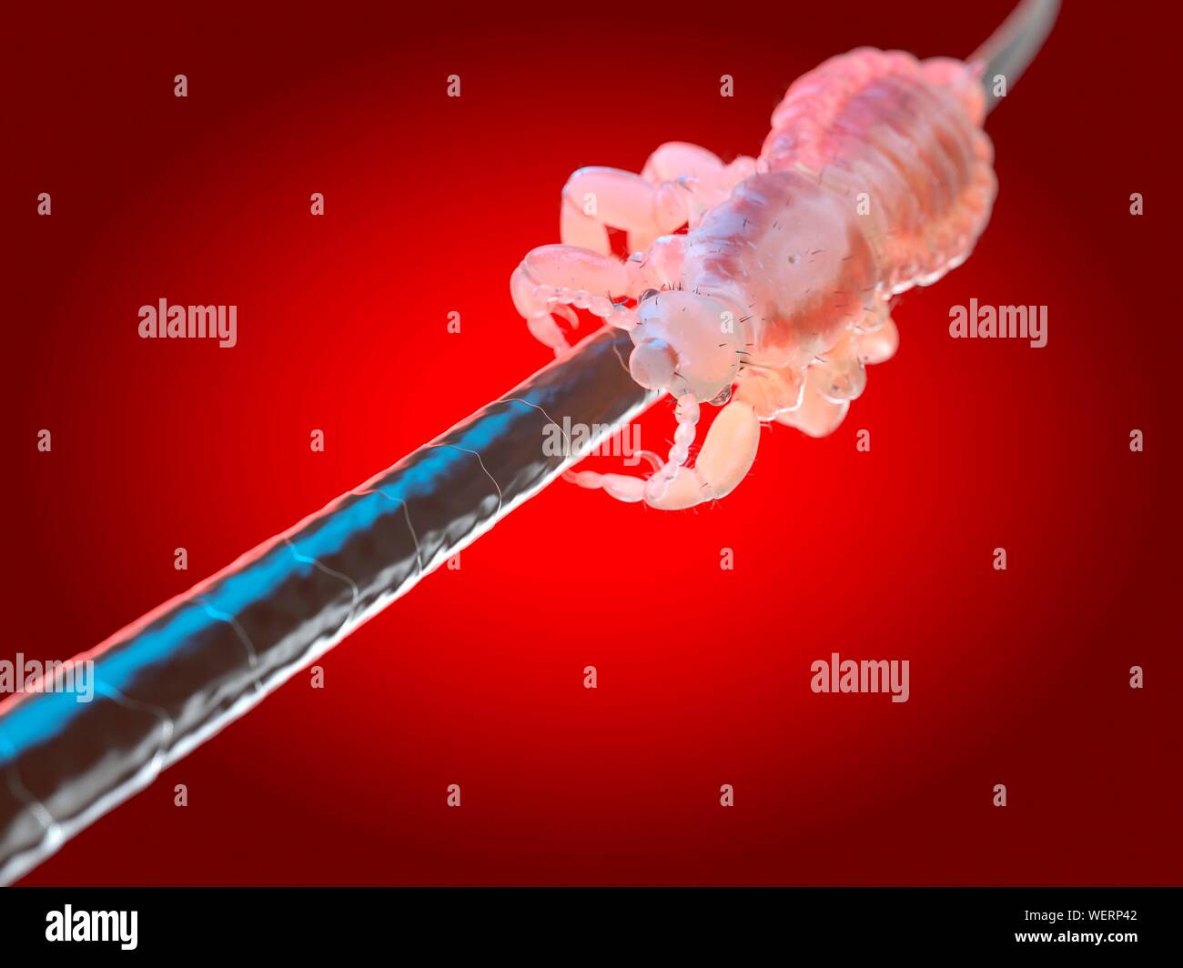 Head louse, illustration Stock Photo - Alamy