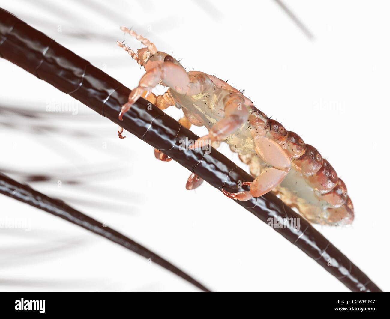 Head louse, illustration Stock Photo - Alamy
