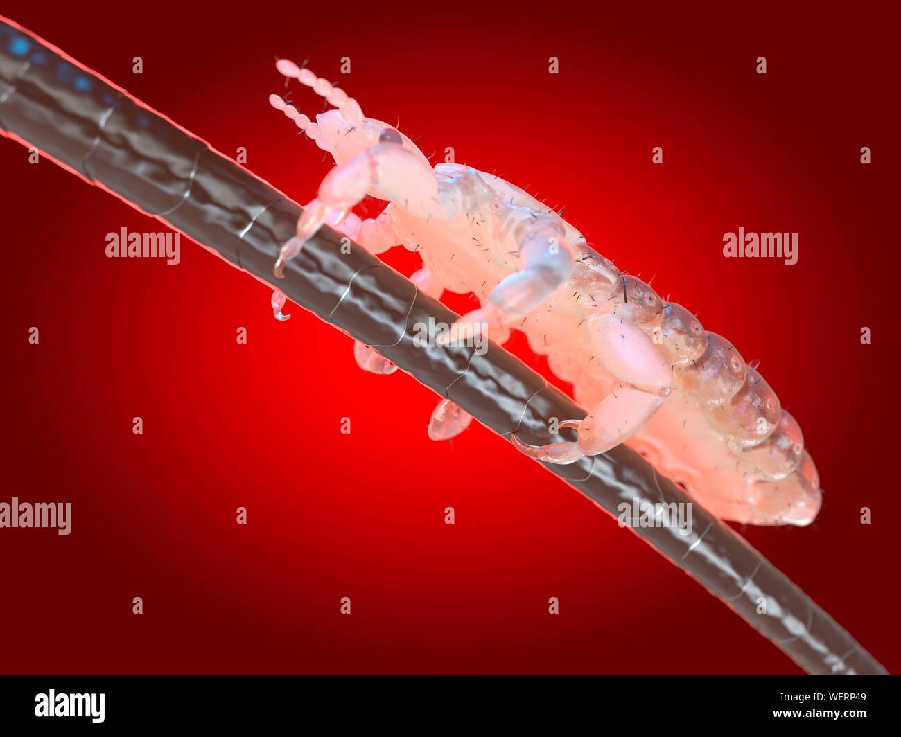 Head louse, illustration Stock Photo - Alamy