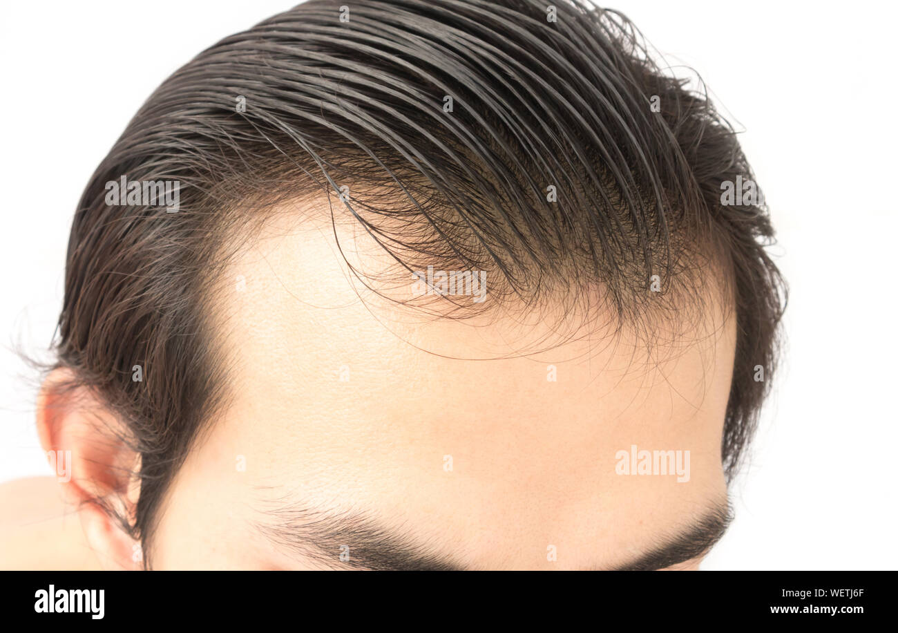 White human head hi-res stock photography and images - Alamy