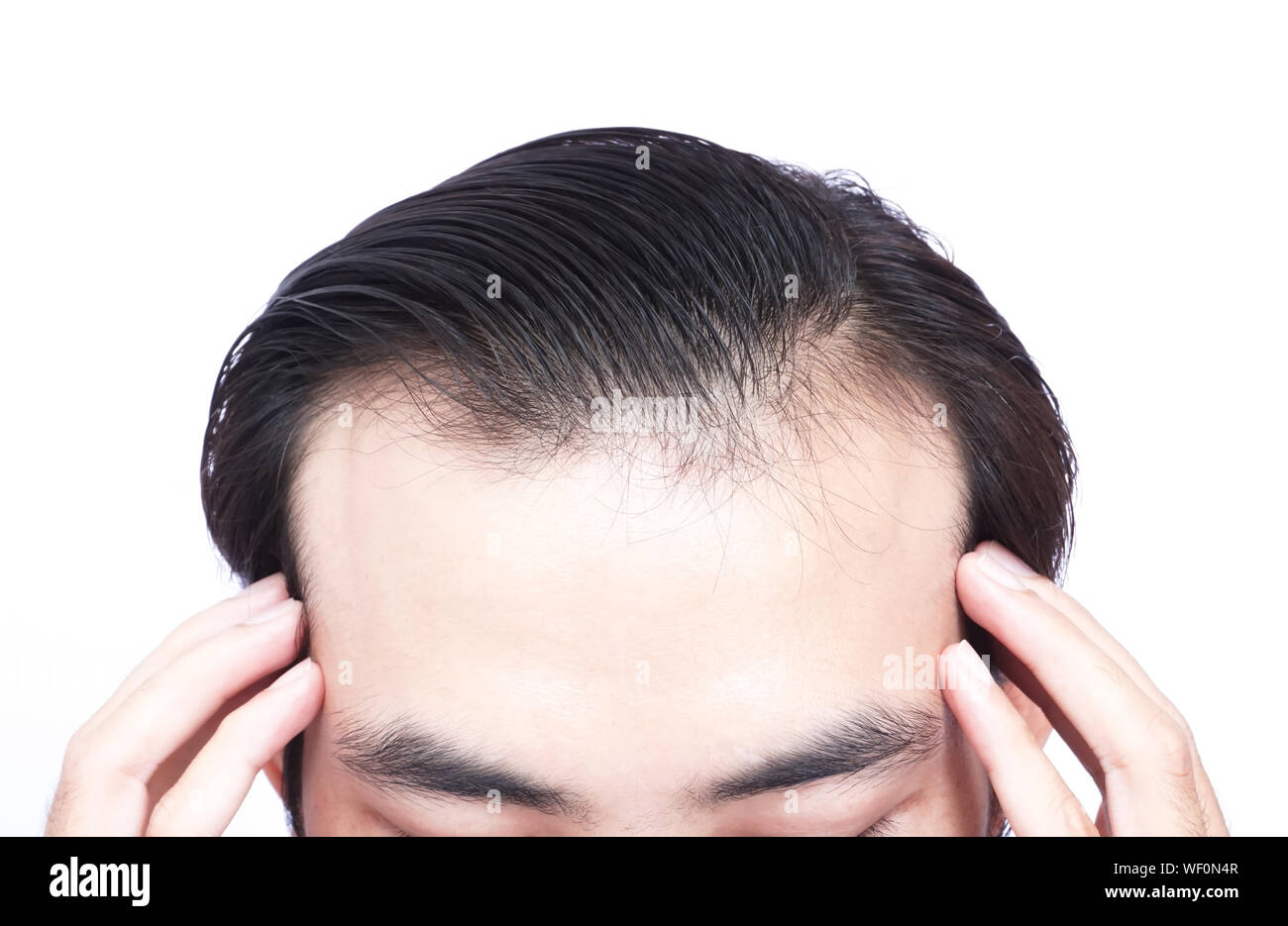 Hands against head hi-res stock photography and images - Alamy