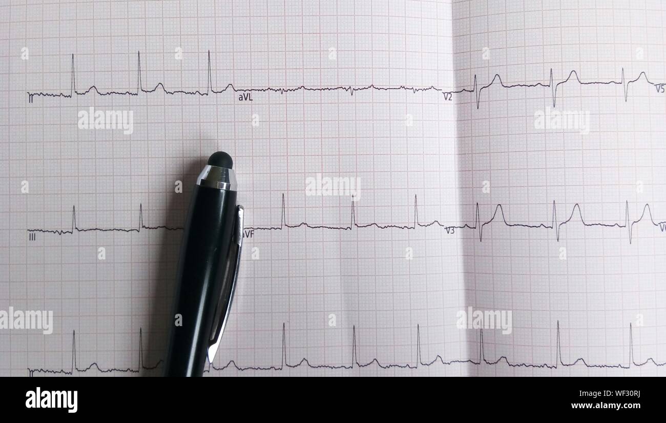 Shadow graph hi-res stock photography and images - Alamy