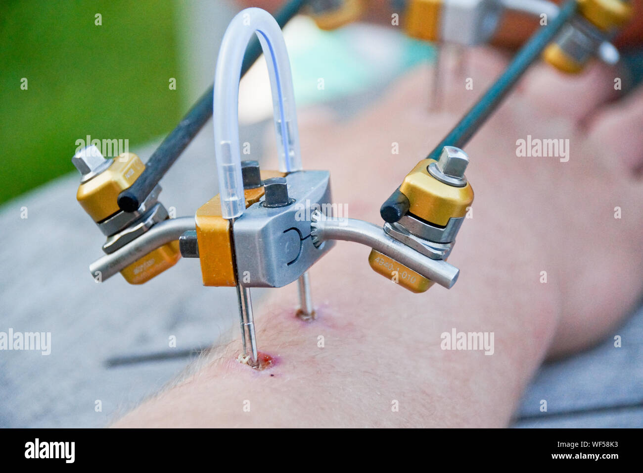 Fixation hi-res stock photography and images - Alamy