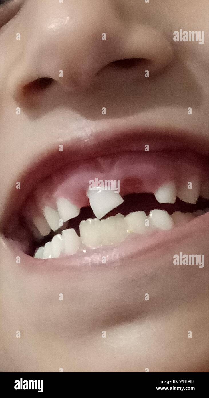 Gap mouth hi-res stock photography and images - Alamy