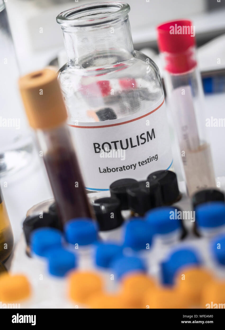 Food microbiology analysis hi-res stock photography and images - Alamy