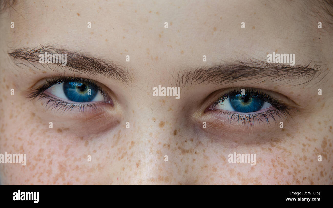 Iris freckles hi-res stock photography and images - Alamy