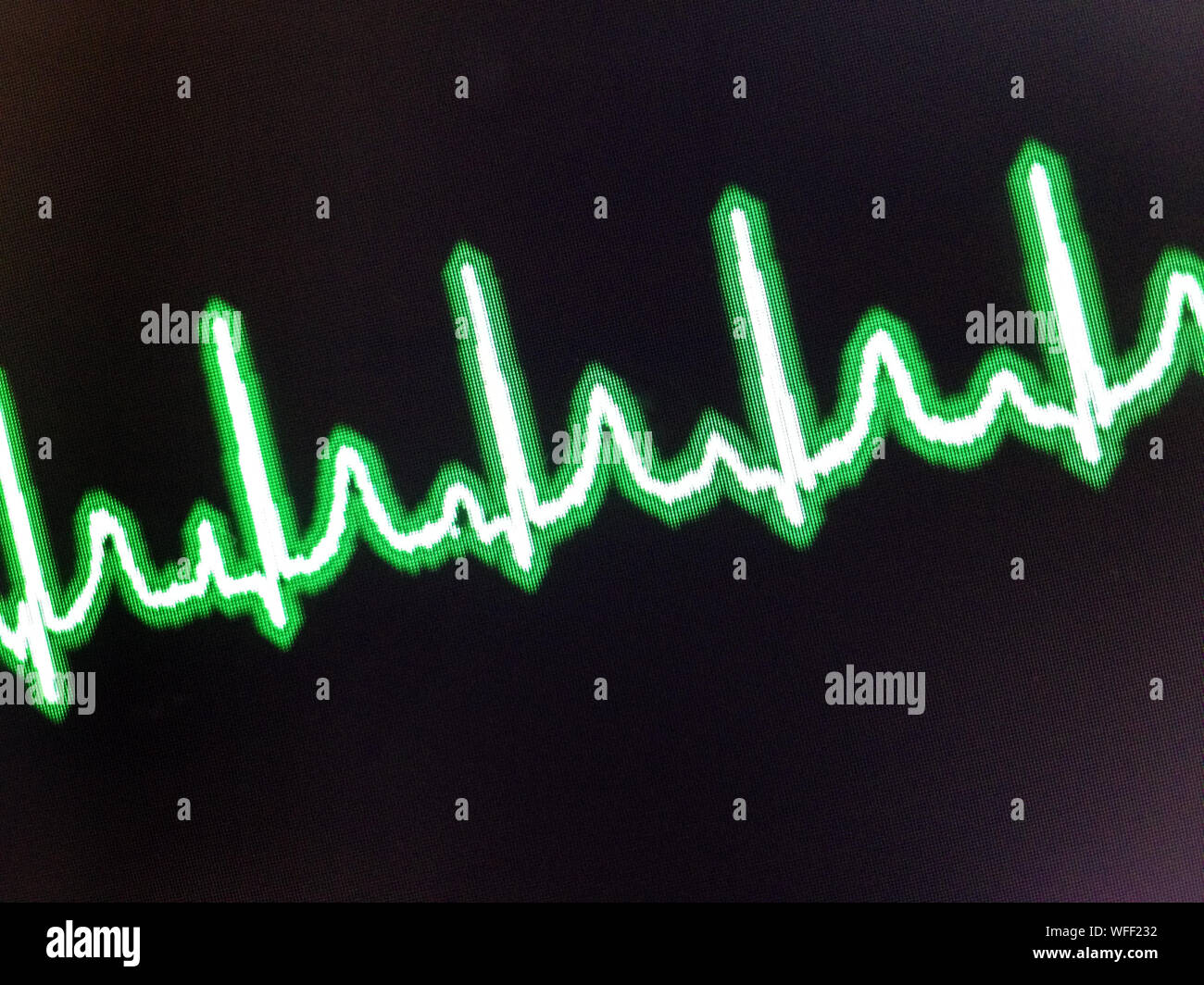 Heartbeat High Resolution Stock Photography and Images - Alamy