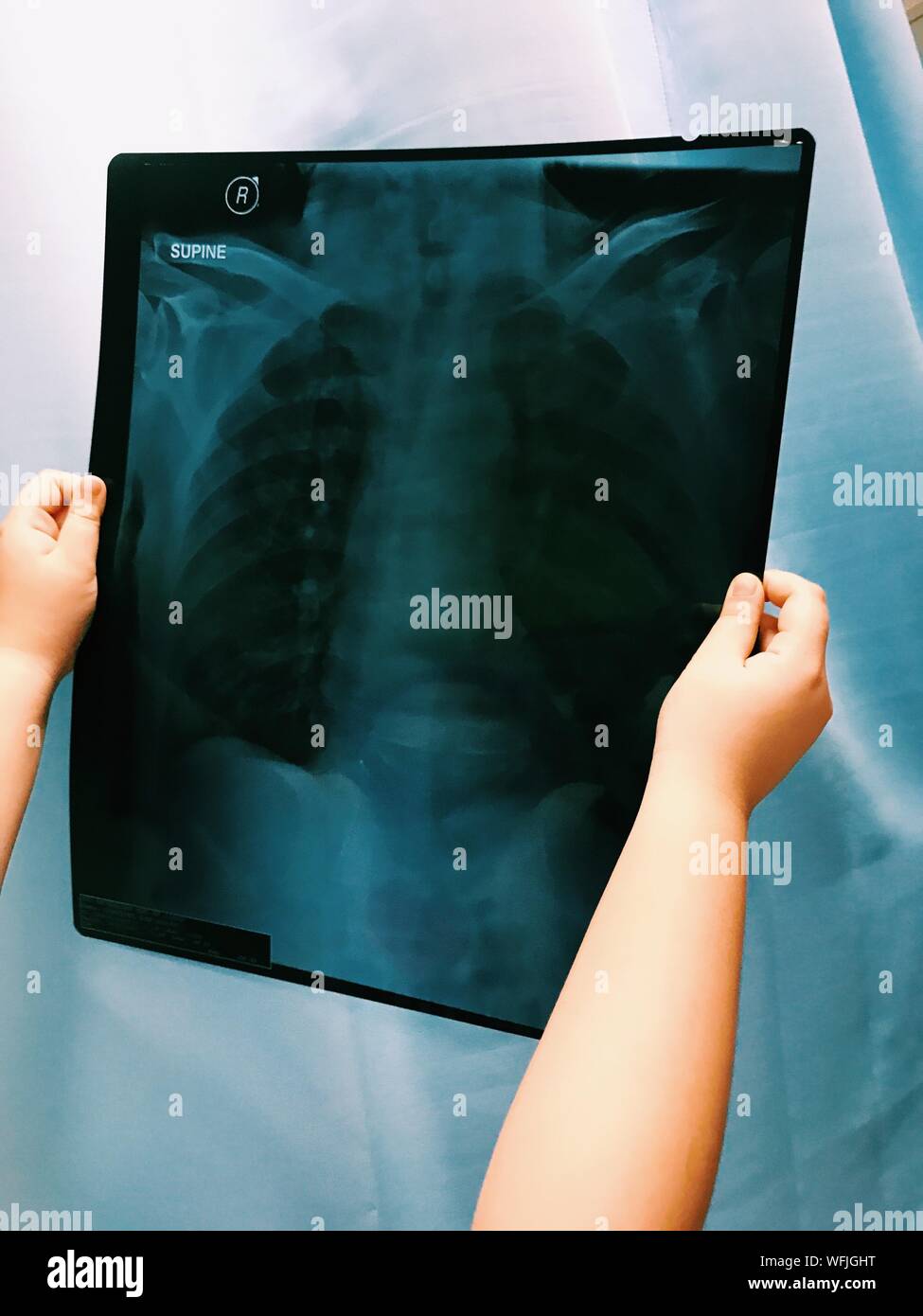 Holding up an x ray hi-res stock photography and images - Alamy