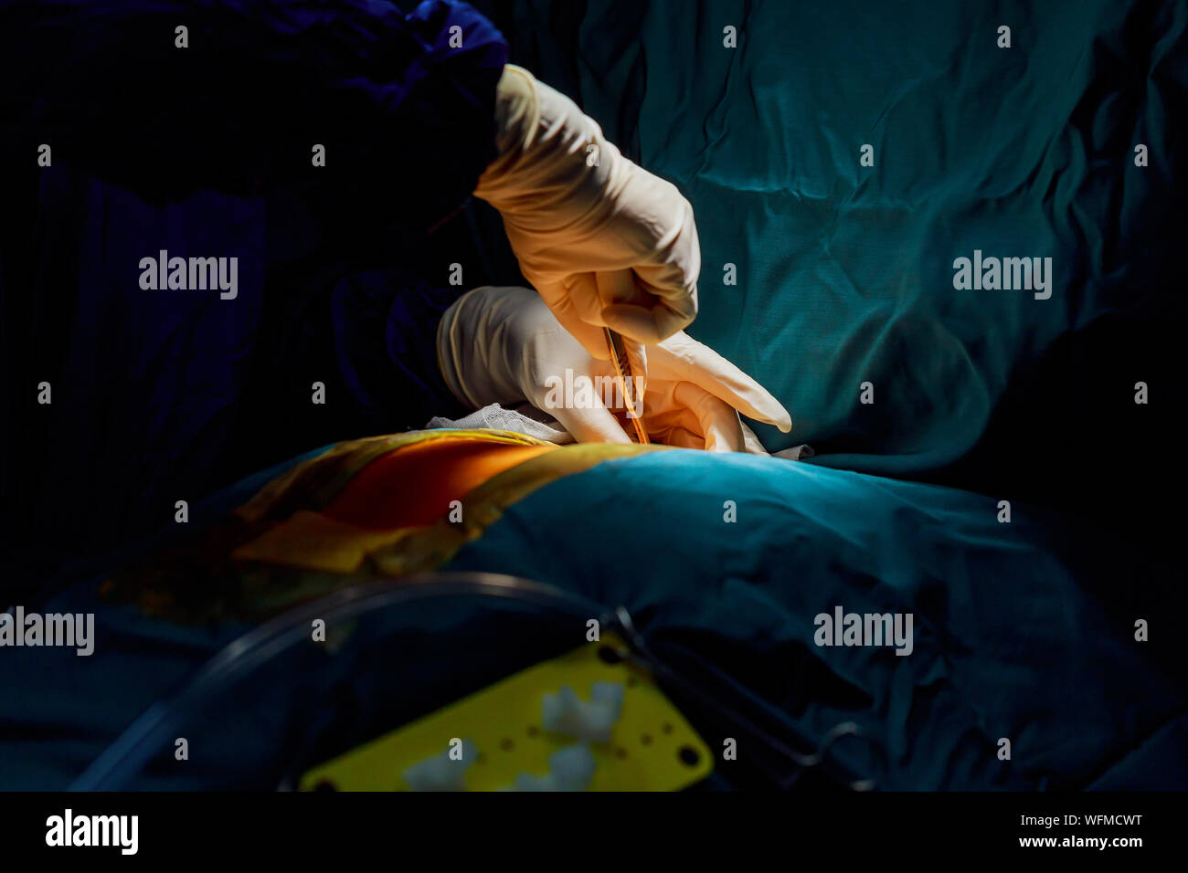 Surgery Bed High Resolution Stock Photography and Images - Alamy