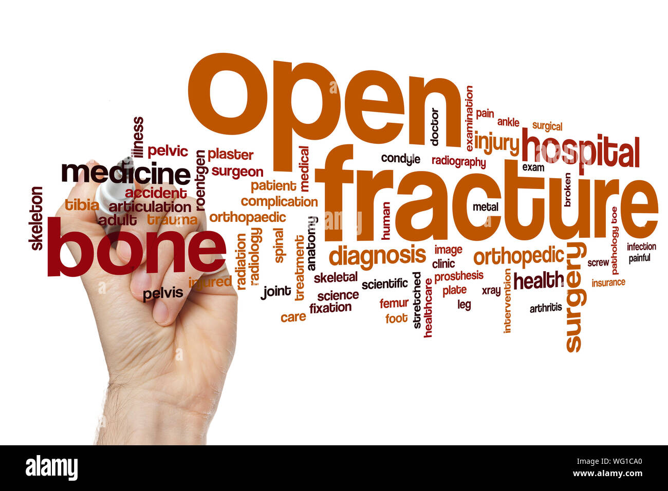 Open fracture word cloud concept Stock Photo - Alamy