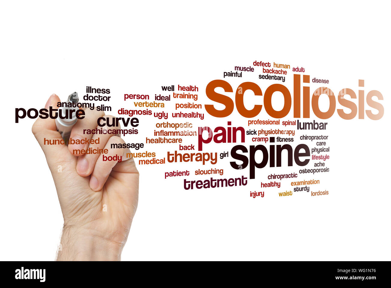 Scoliosis word cloud concept Stock Photo - Alamy