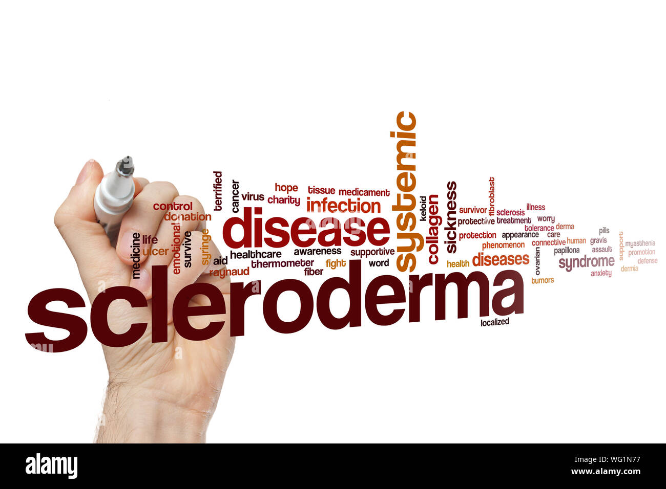Scleroderma word cloud concept Stock Photo - Alamy