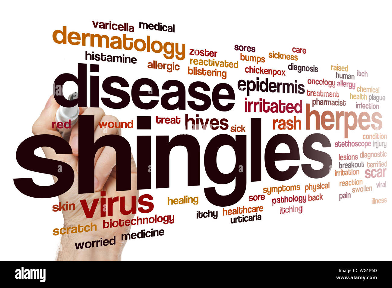 Shingles scar hi-res stock photography and images - Alamy