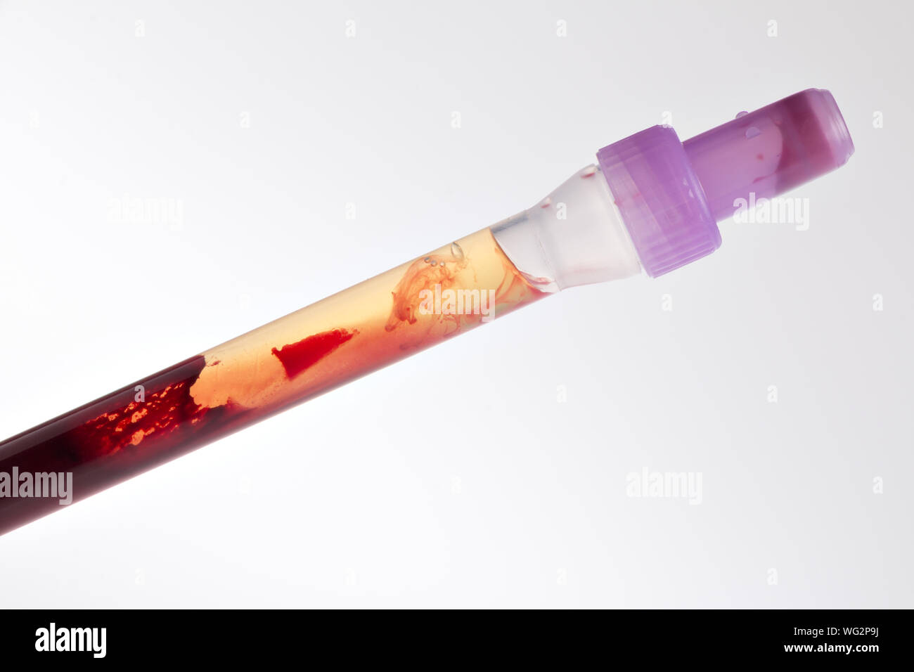 Medical sample hi-res stock photography and images - Alamy