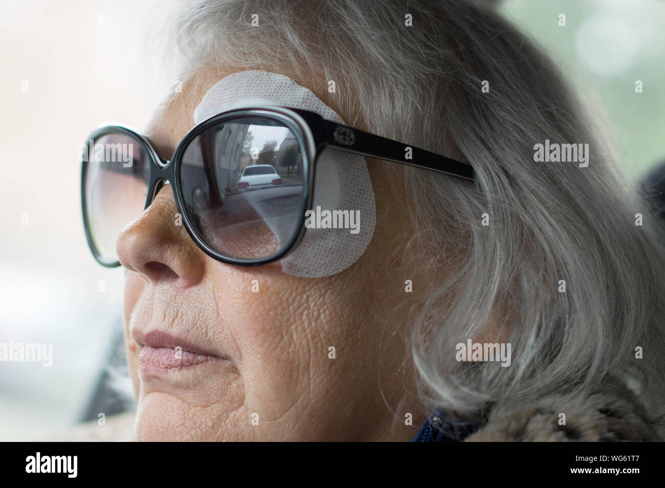 Bandage eye hi-res stock photography and images - Alamy