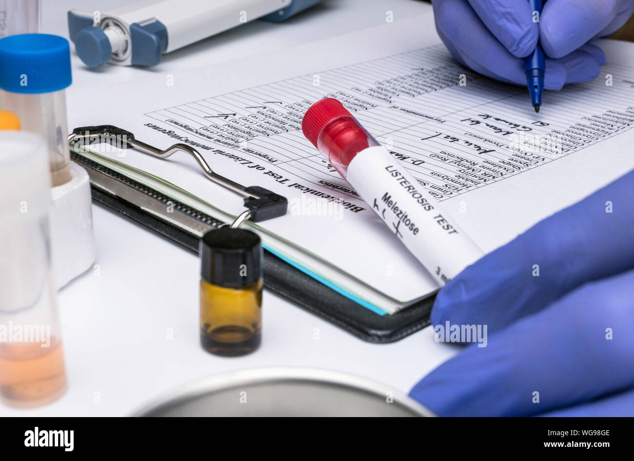 Scientist analyzes listeria sample in laboratory, conceptual image ...