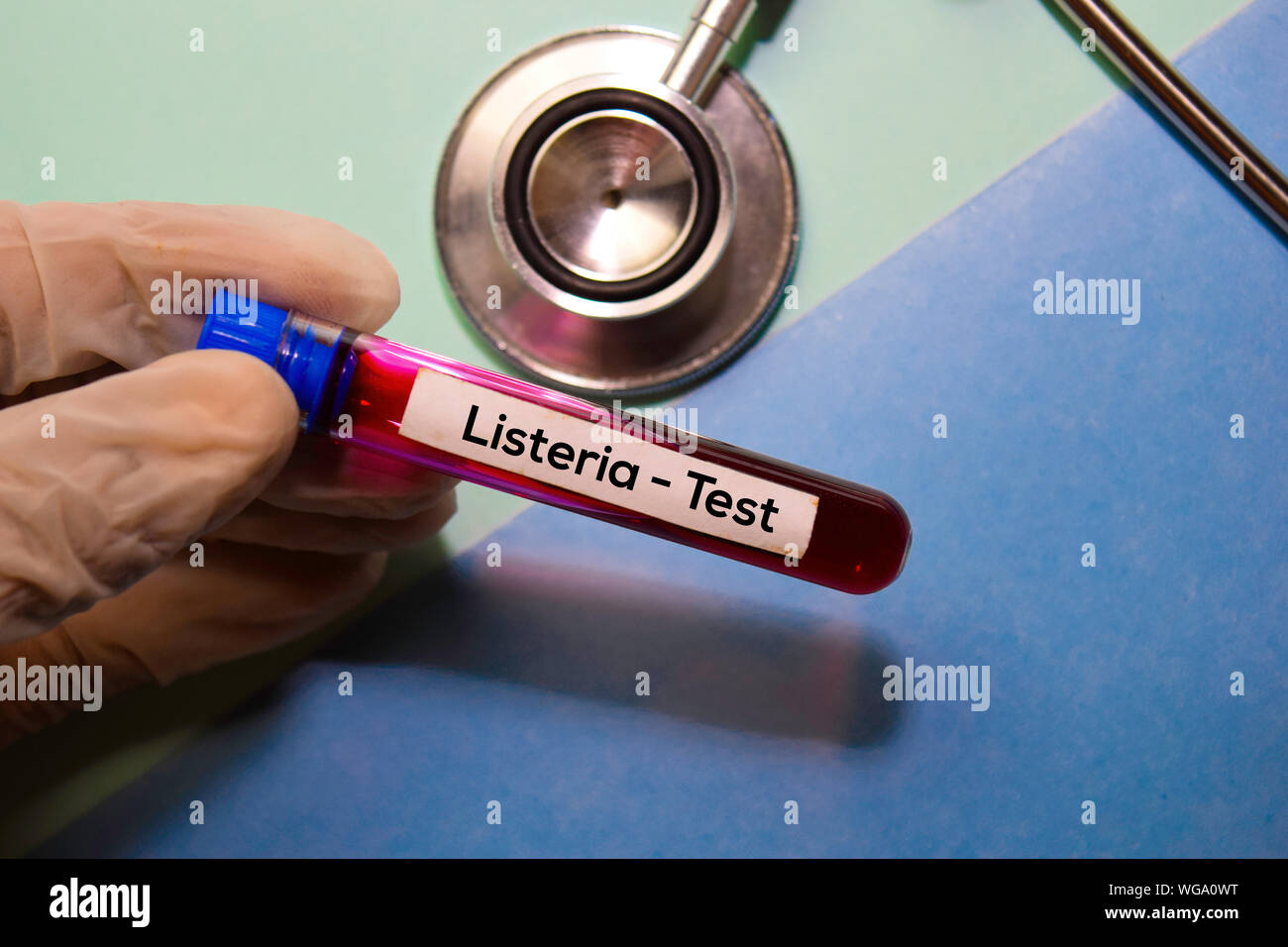 Listeria - Test with blood sample. Top view isolated on office desk ...