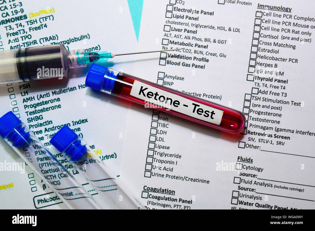 Ketone - Test with blood sample. Top view isolated on office desk ...