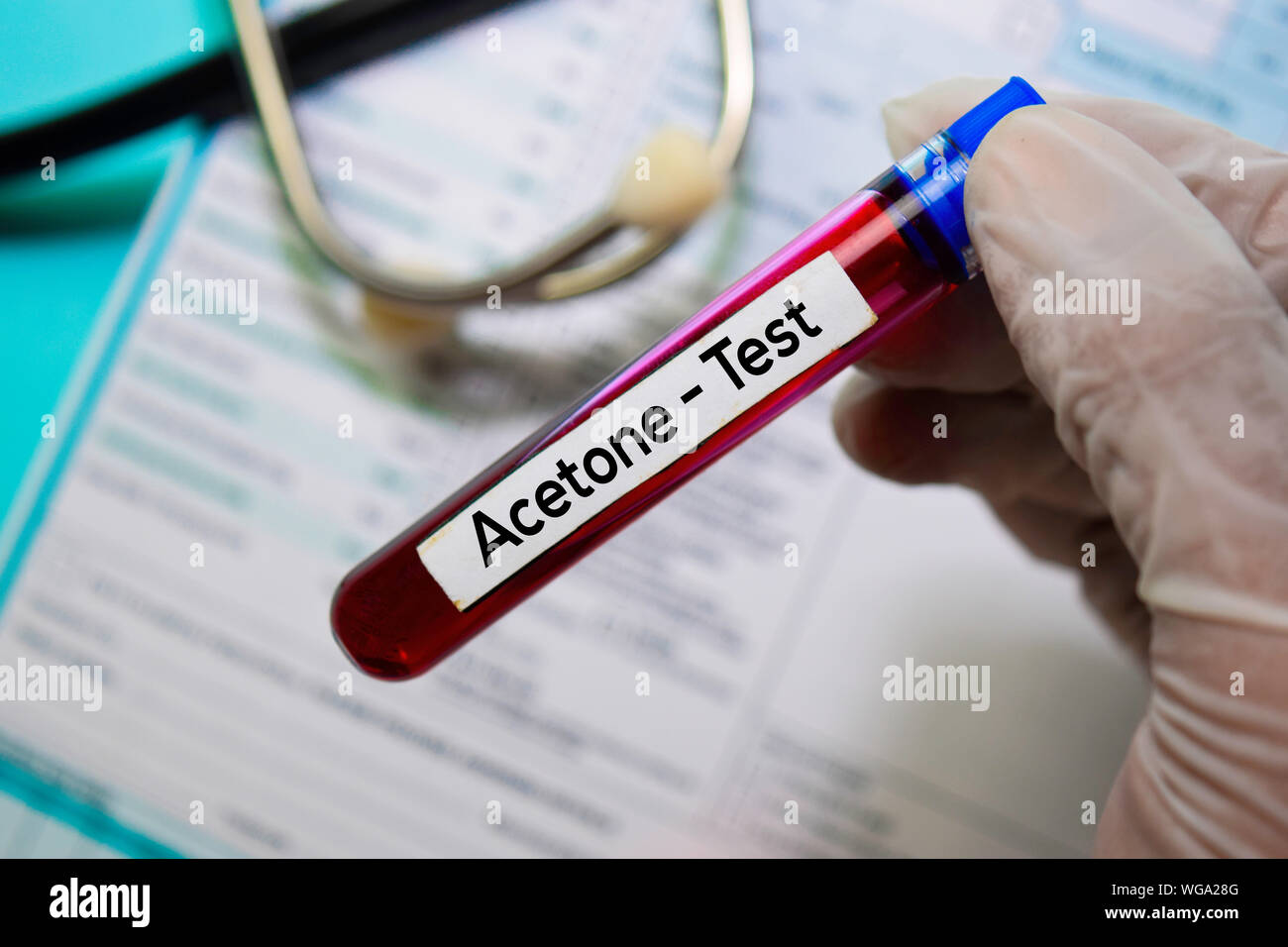 Acetone - Test with blood sample. Top view isolated on office desk ...