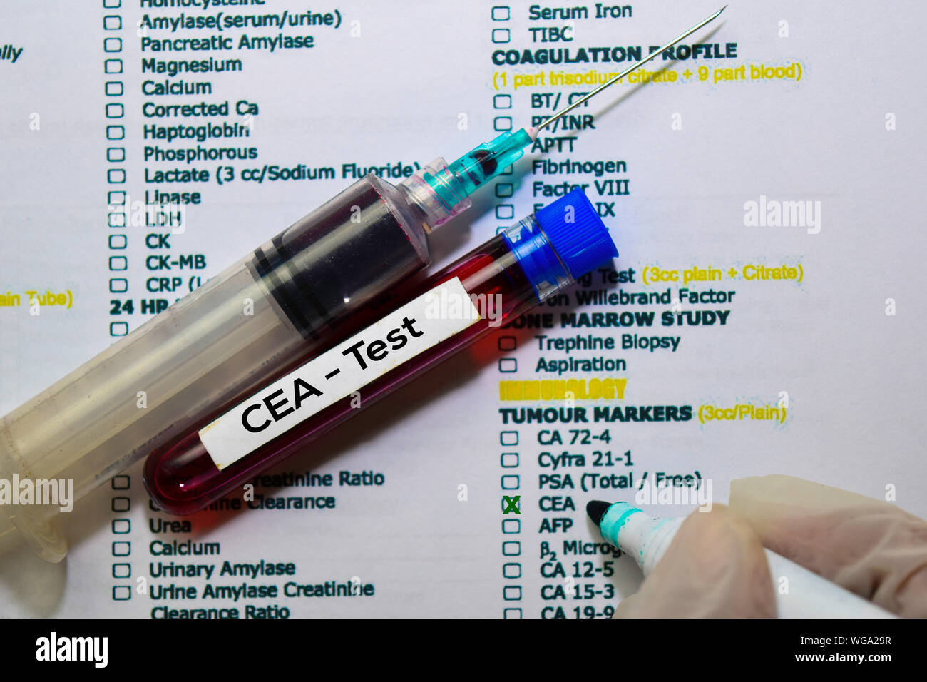 CEA - Test with blood sample. Top view isolated on office desk ...