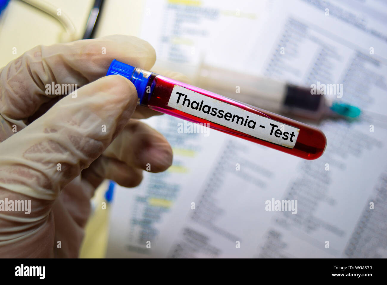 Thalassemia - Test with blood sample. Top view isolated on office desk ...