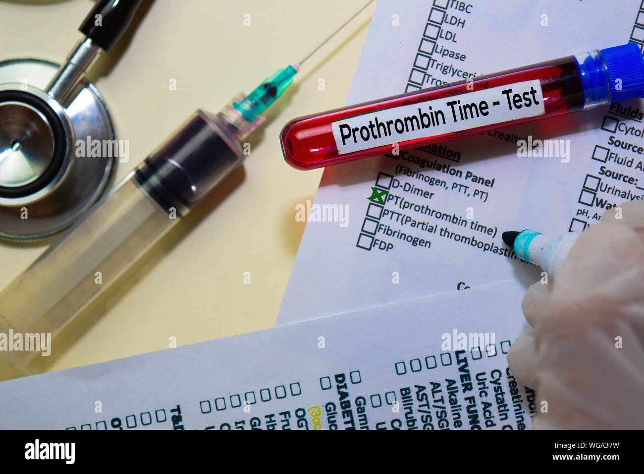 Prothrombin hi-res stock photography and images - Alamy