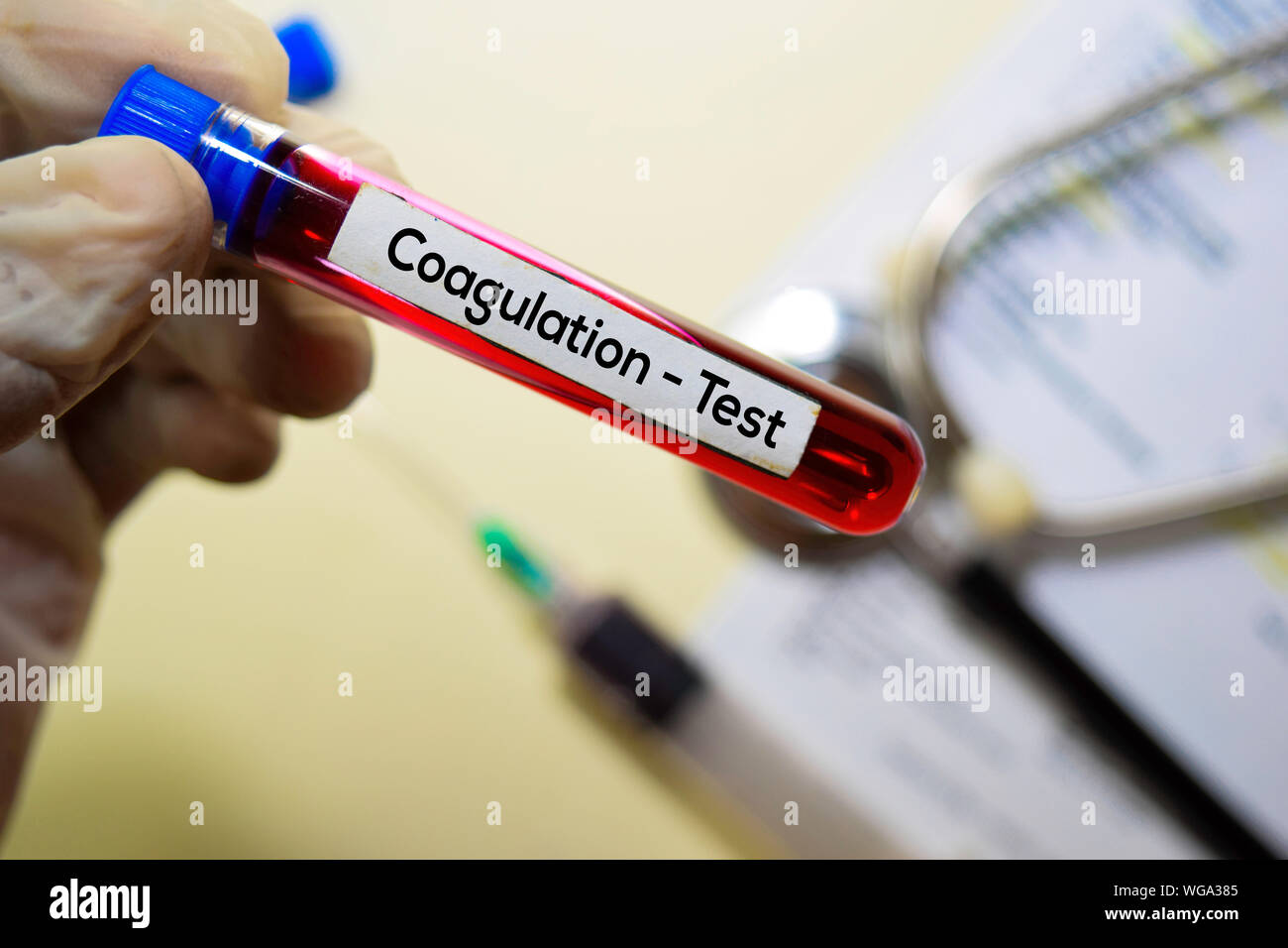 Coagulation - Test with blood sample. Top view isolated on office desk ...
