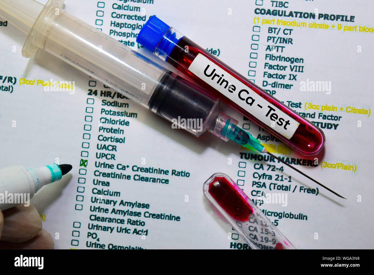 Urine Ca (Creatinine Ratio) - Test with blood sample. Top view isolated ...