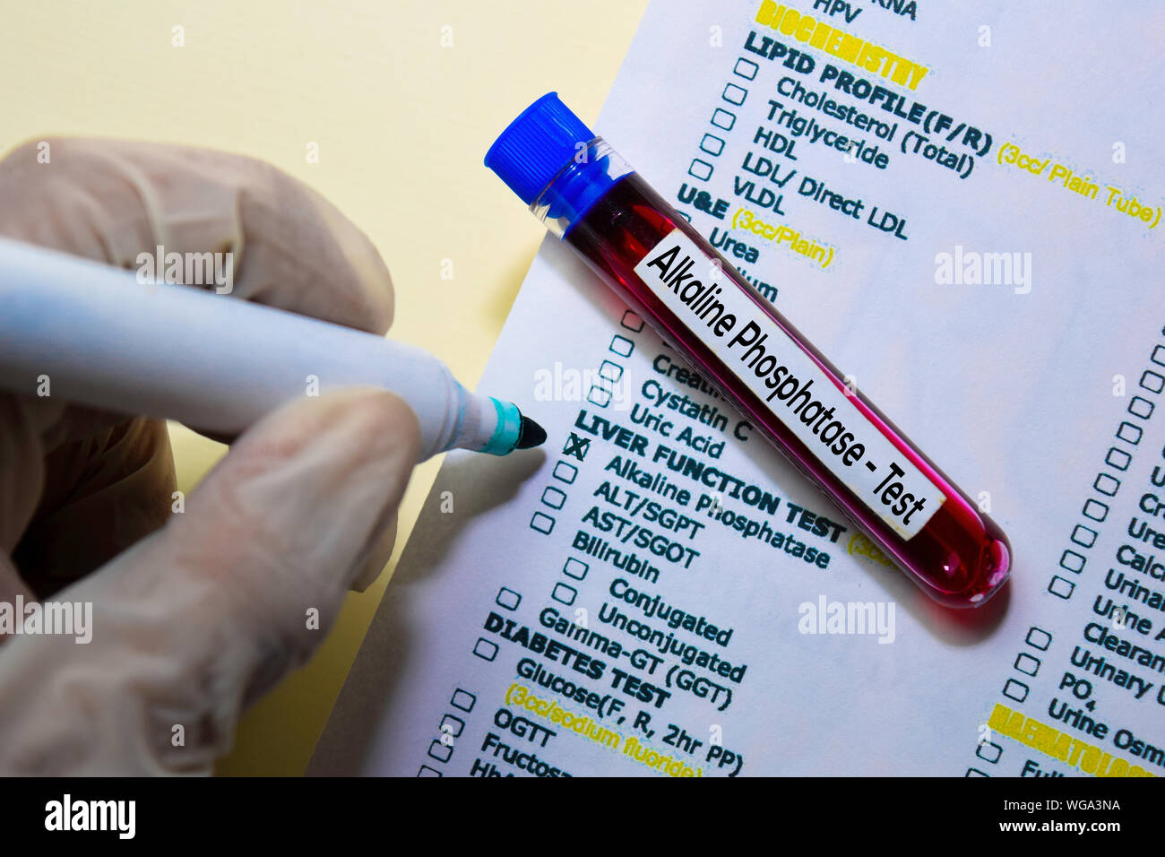 Alkaline Phosphatase - Test with blood sample. Top view isolated on ...