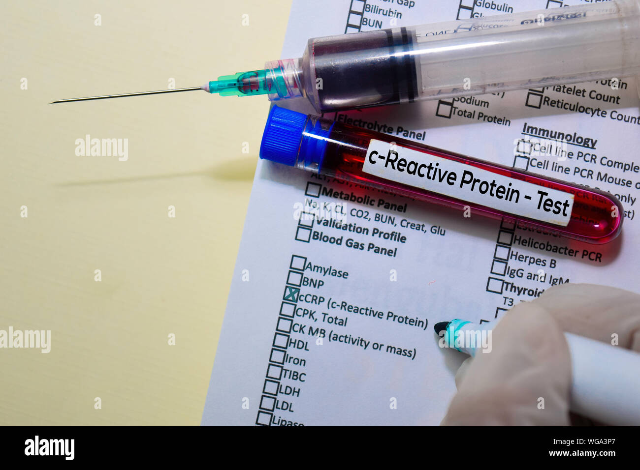 c-Reactive Protein - Test with blood sample. Top view isolated on ...