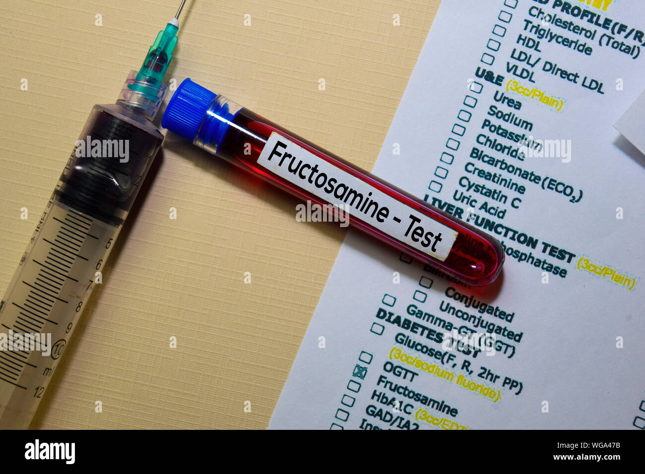 Fructosamine - Test with blood sample. Top view isolated on office desk ...