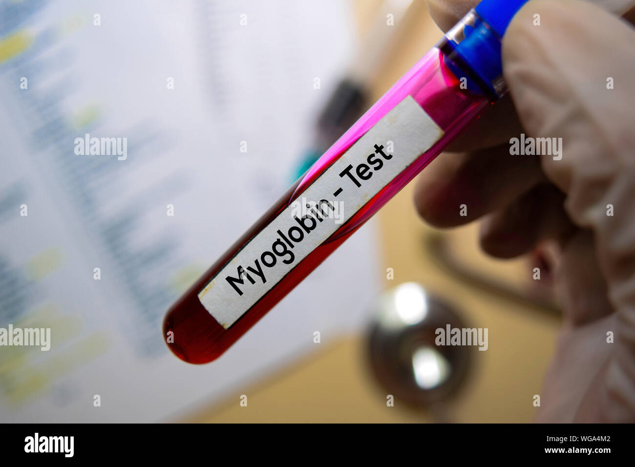 Myoglobin - Test with blood sample. Top view isolated on office desk ...