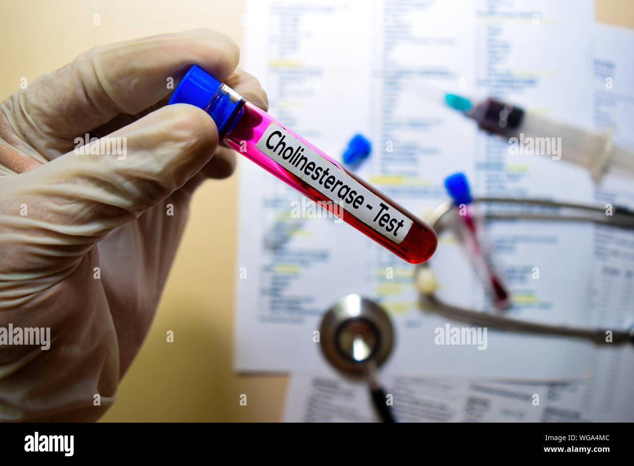 Cholinesterase - Test with blood sample. Top view isolated on office ...
