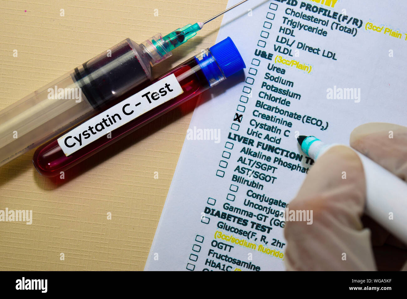 Cystatin C - Test with blood sample. Top view isolated on office desk ...