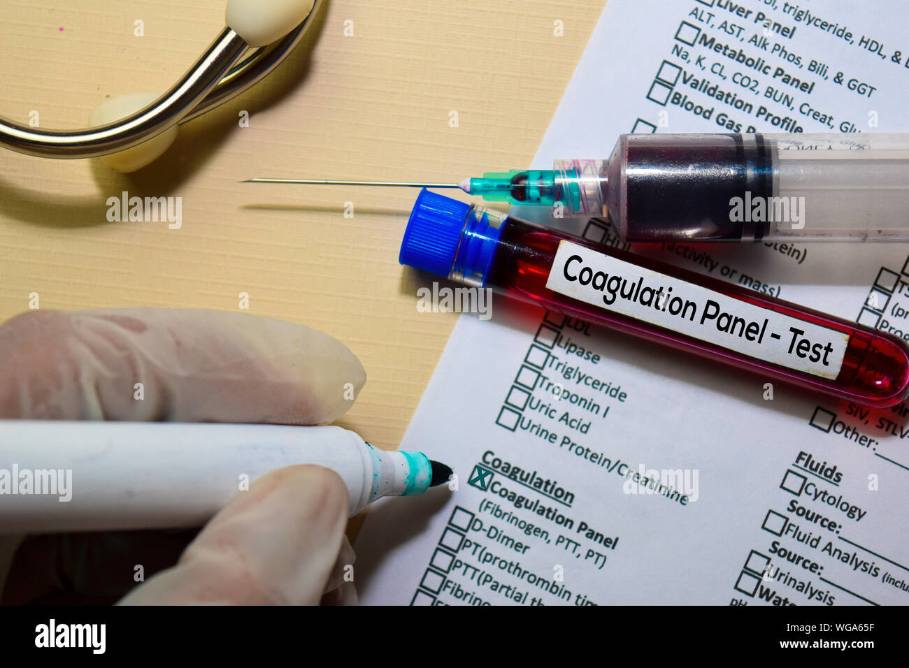 Coagulation Panel - Test with blood sample. Top view isolated on office ...