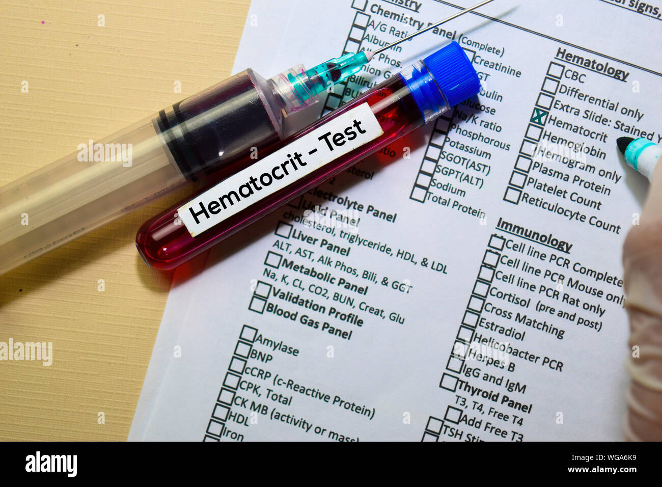 Hematocrit - Test with blood sample. Top view isolated on office desk ...