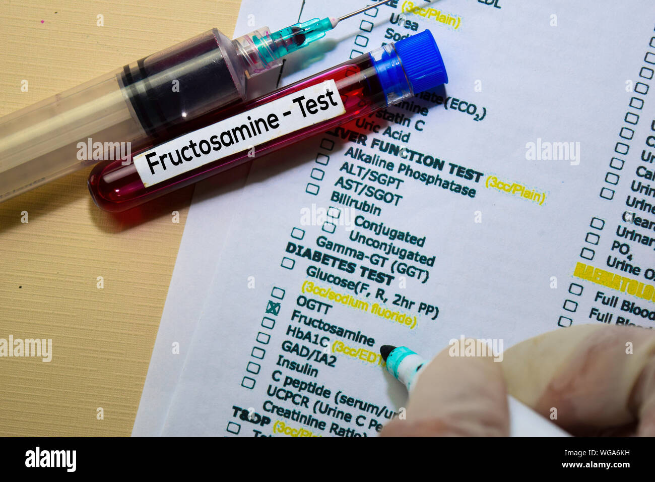 Fructosamine - Test with blood sample. Top view isolated on office desk ...