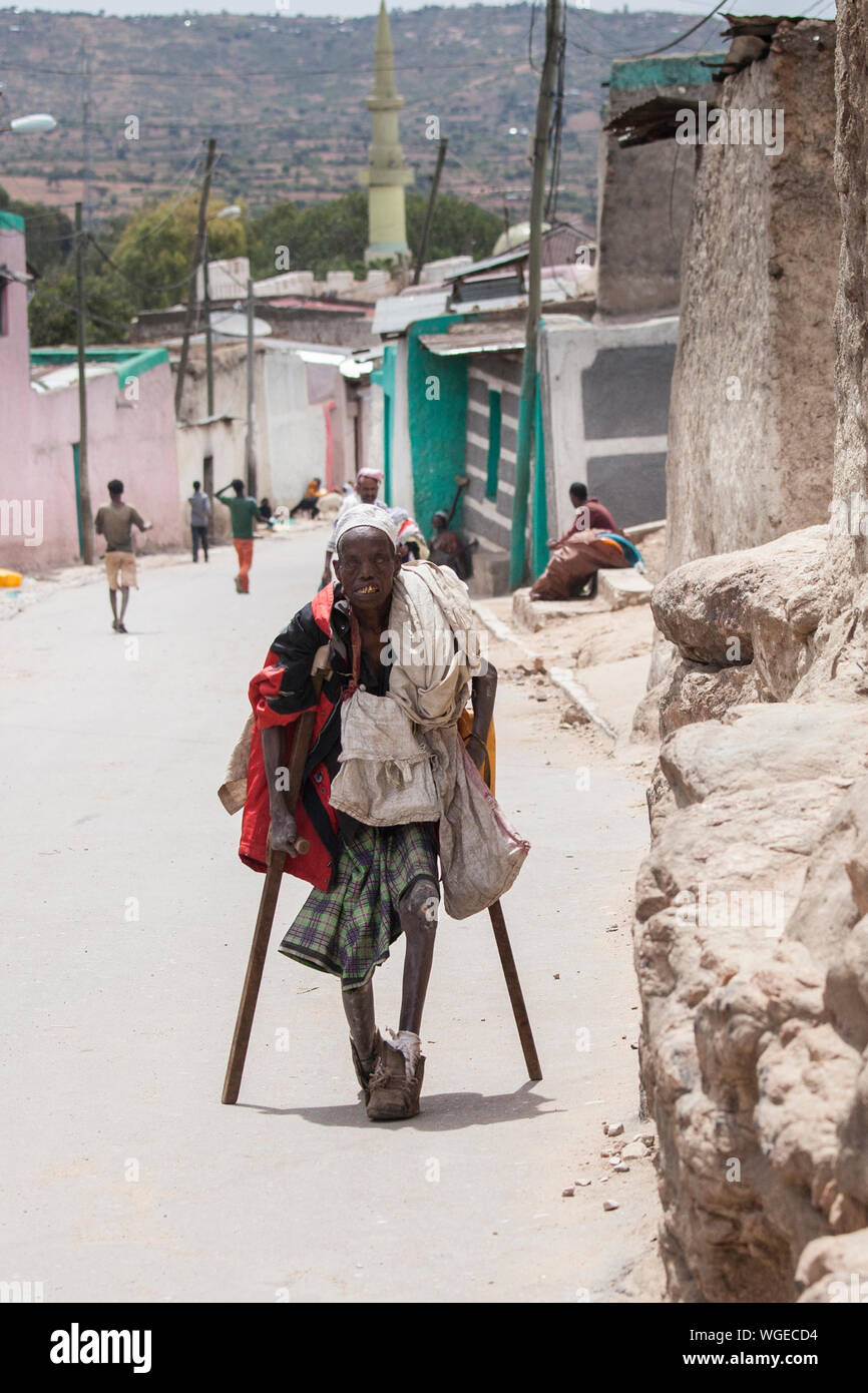 HARER, ETHIOPIA-APRIL 17, 2015: Unidentified man with severe leprosy ...
