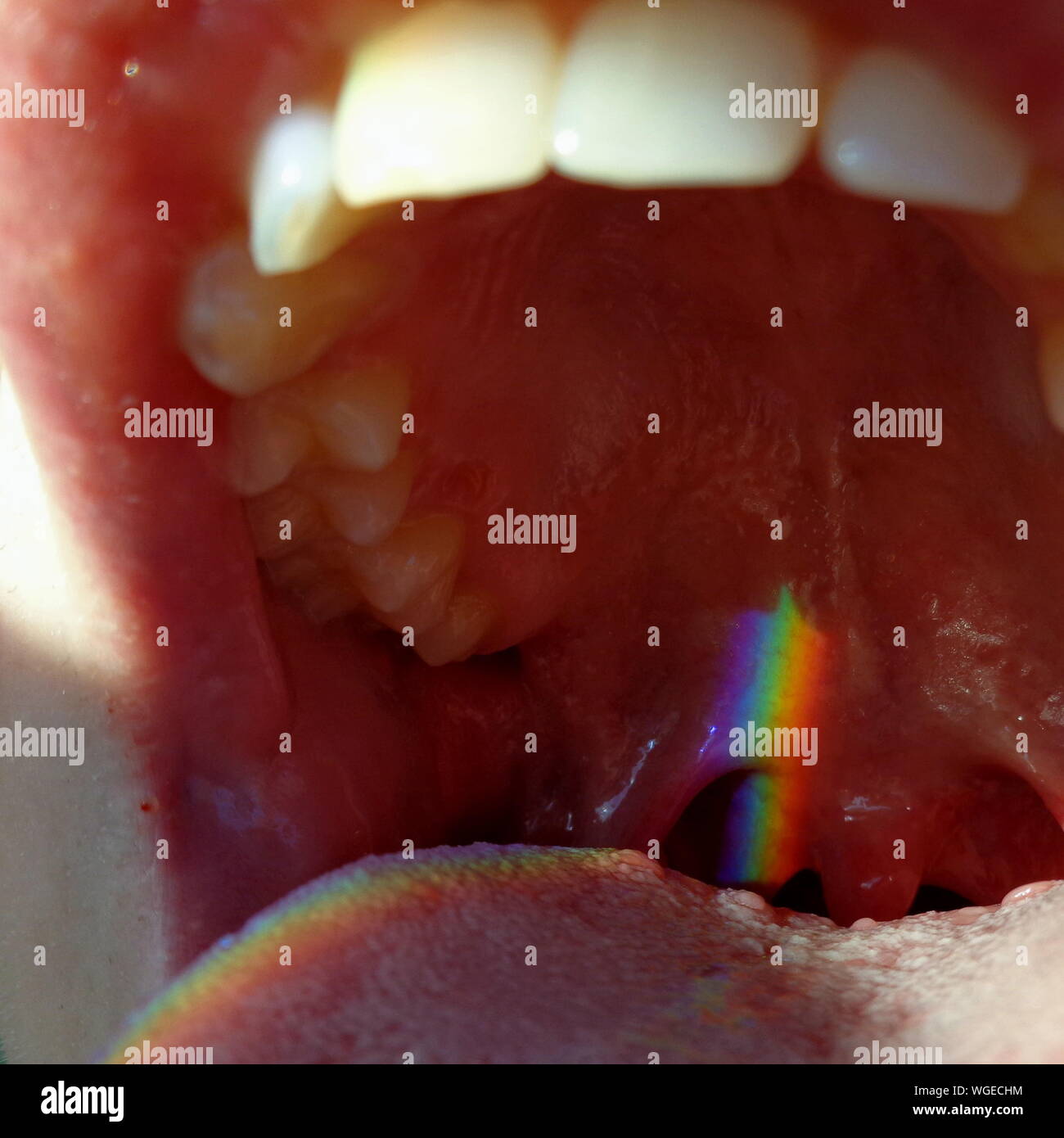 Human teeth skin hi-res stock photography and images - Alamy