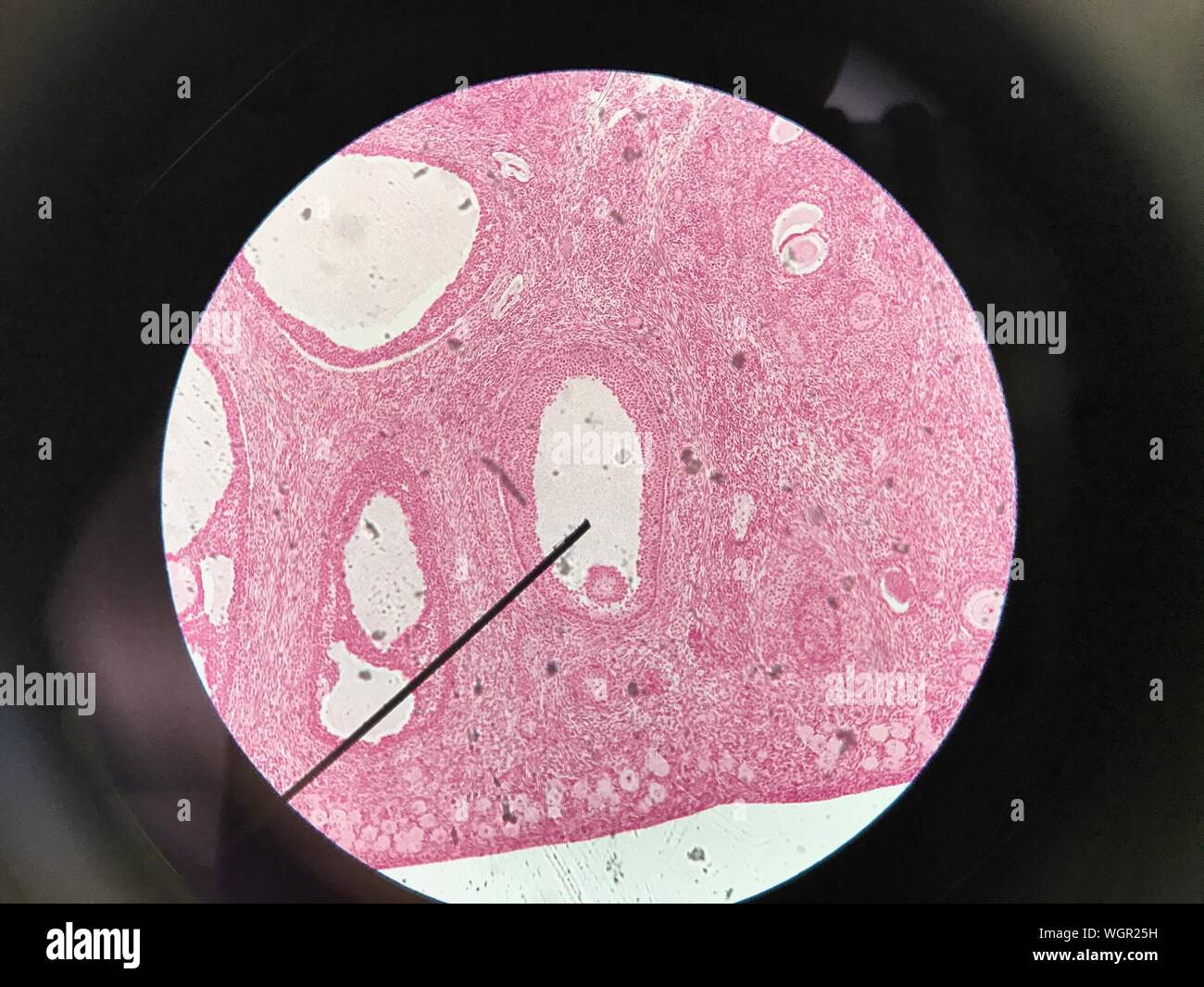 Ovary High Resolution Stock Photography and Images - Alamy
