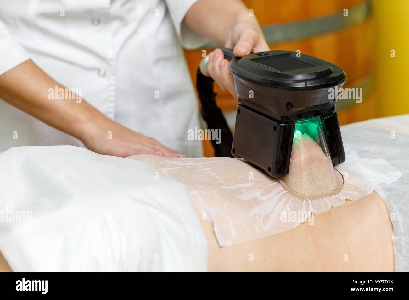 Cryolipolysis fat freezing treatment. Weight loss and slimming ...