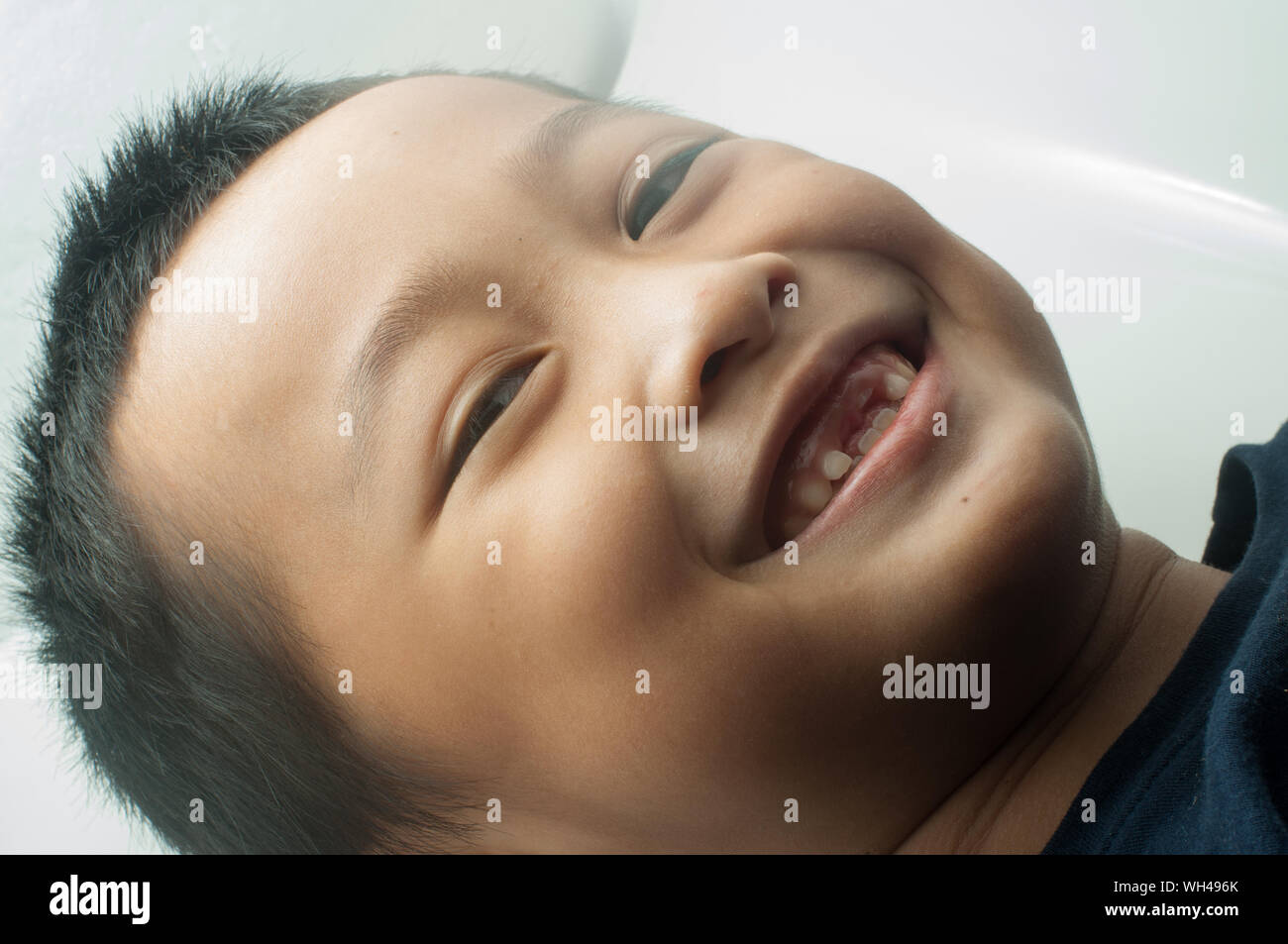 Boy broken teeth hi-res stock photography and images - Alamy