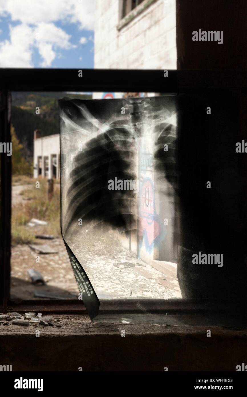 Chest X Ray High Resolution Stock Photography and Images - Alamy